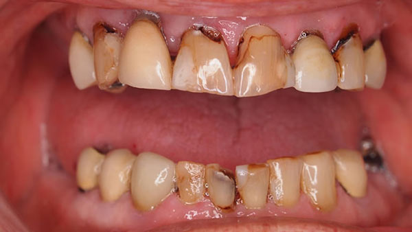 Dentist in San Diego, CA - Smile Gallery Mission Valley Dental Arts ...